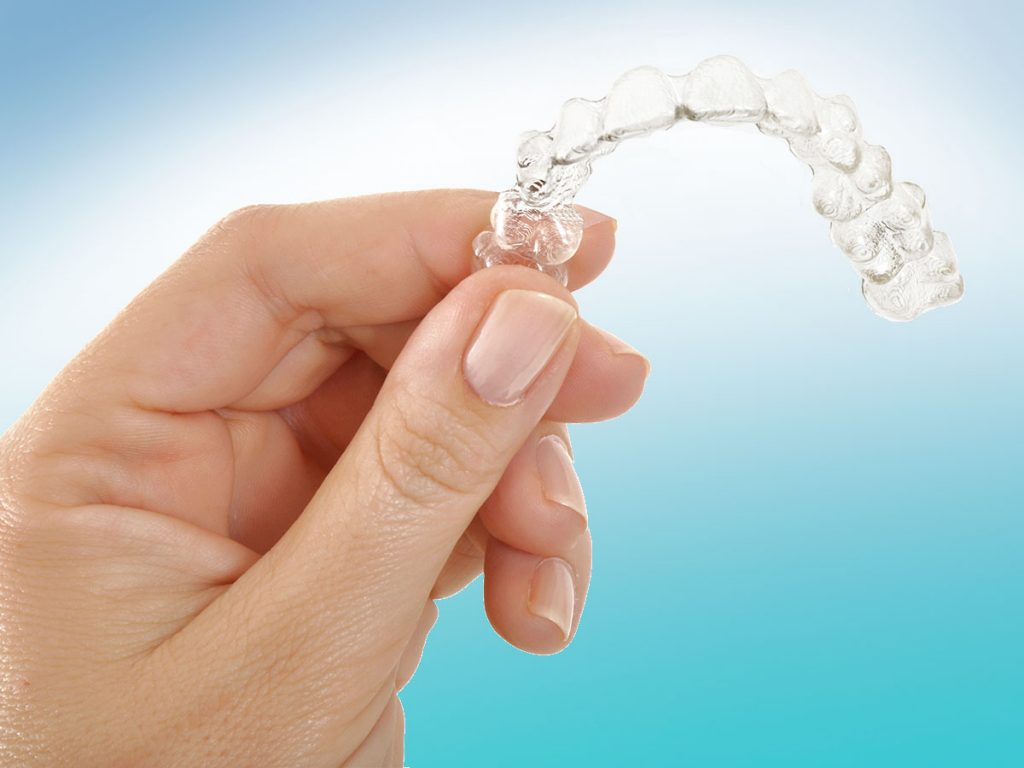 Invisalign_tecnologia_sérgio_casarim_juizdefora_ortodontista - Sérgio ...
